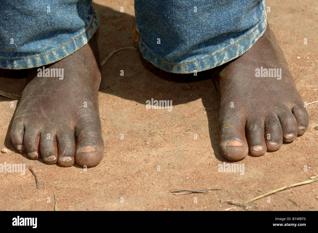Close up of African childs dusty feet Kenya Africa Stock Photo - Alamy