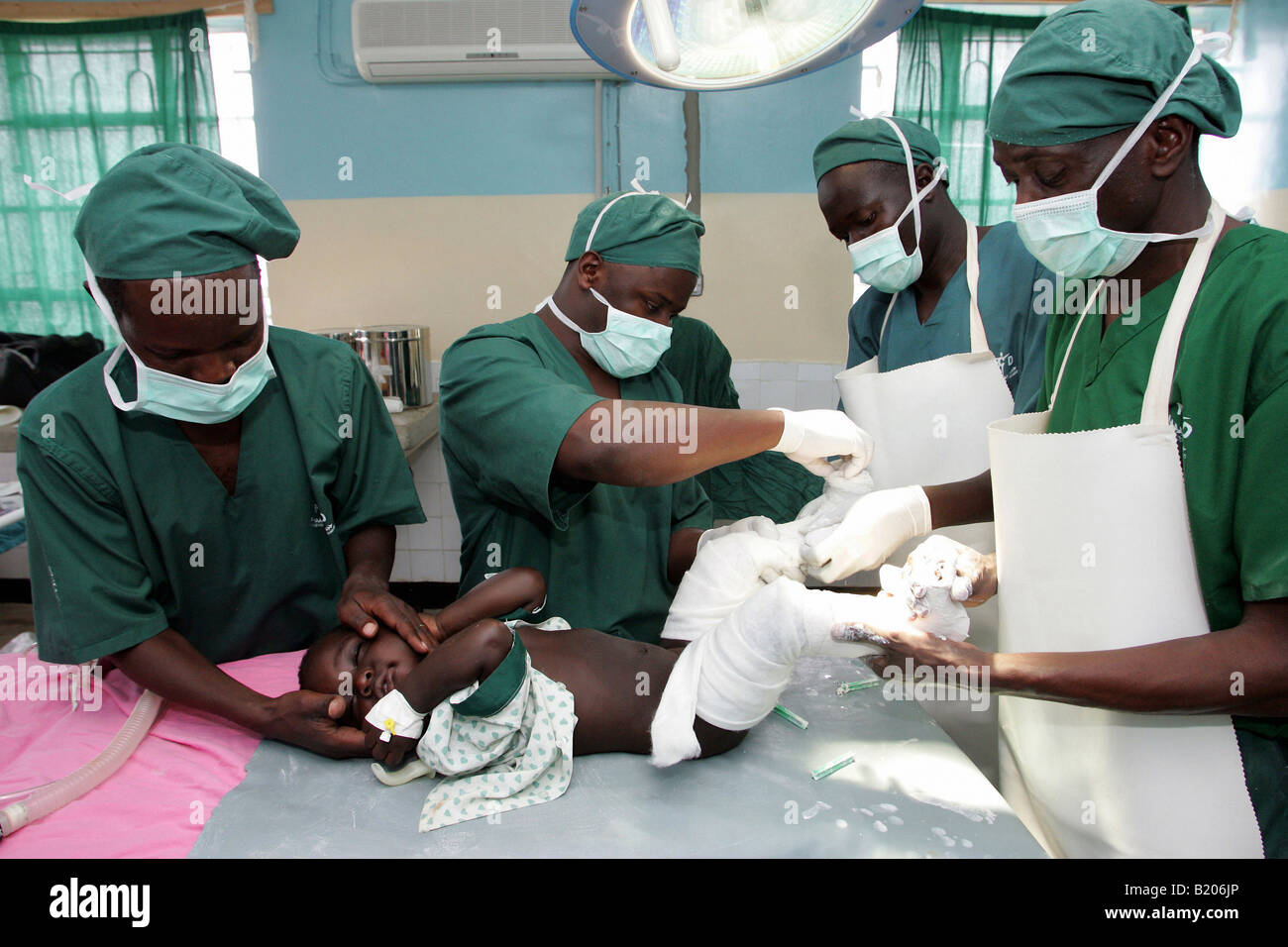 Clubfoot hi-res stock photography and images - Alamy