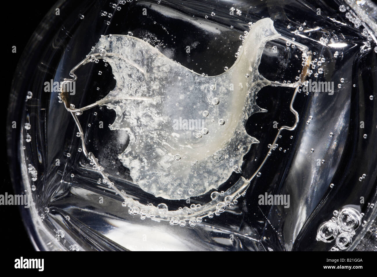 Retainer dentist child hi-res stock photography and images - Alamy