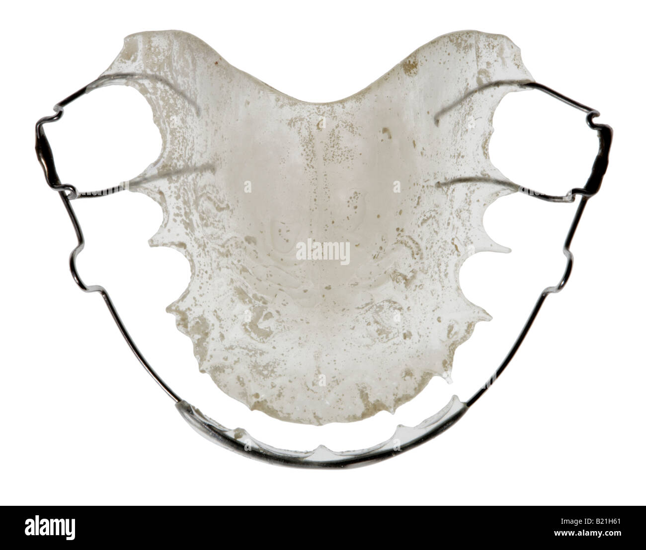 Retainer Retainer Orthodontic Stock Photos & Retainer Retainer ...