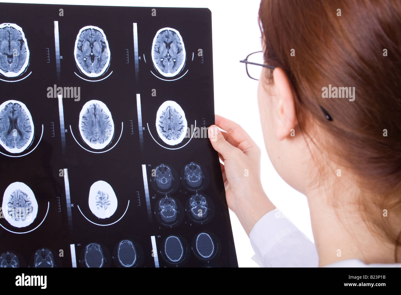 Female doctor examining a brain cat scan Stock Photo - Alamy