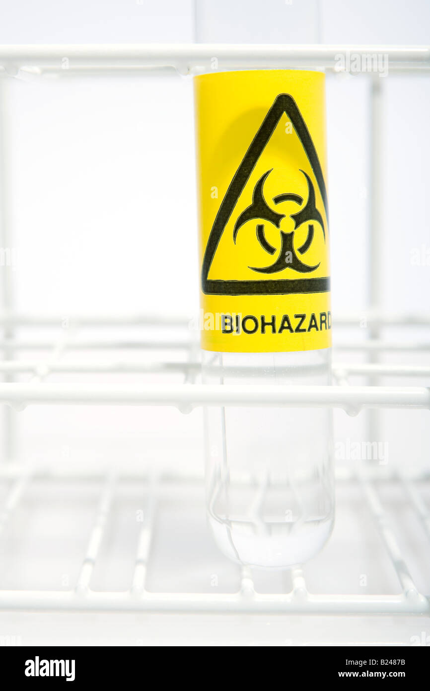 Biohazard label on a test tube Stock Photo - Alamy