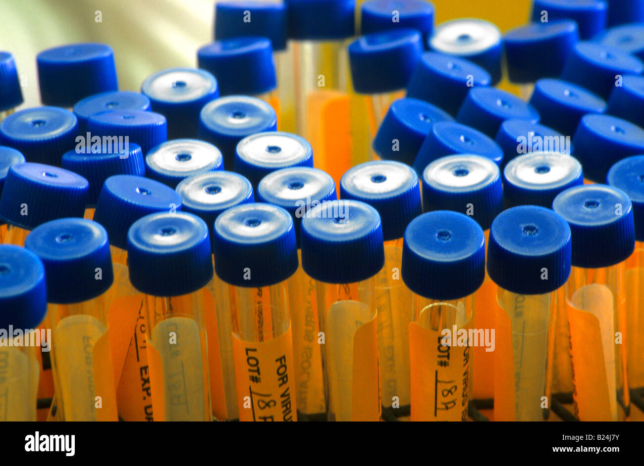 Pathology lab hi-res stock photography and images - Alamy