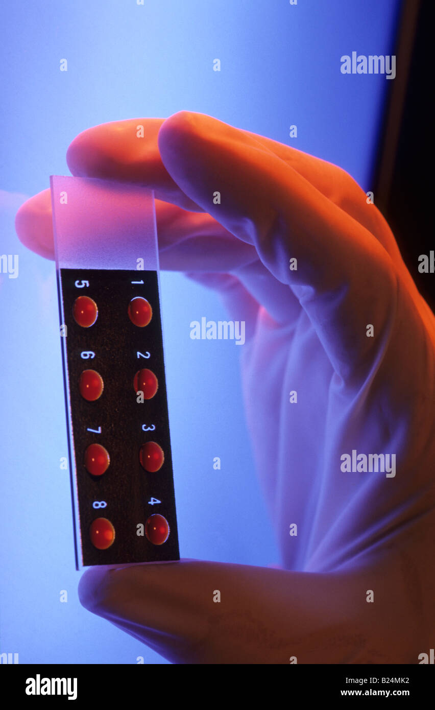 CLOSE UP GLOVED HAND HOLDING LABORATORY SLIDE Stock Photo - Alamy