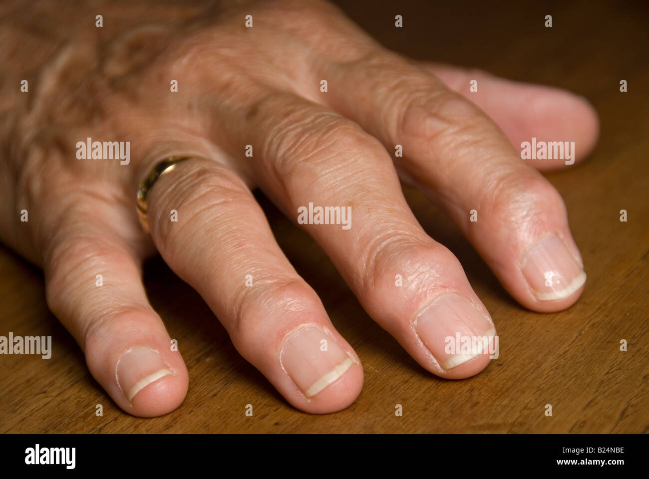 Stock photo of a pensioners hand The shape of her hand is commonly ...