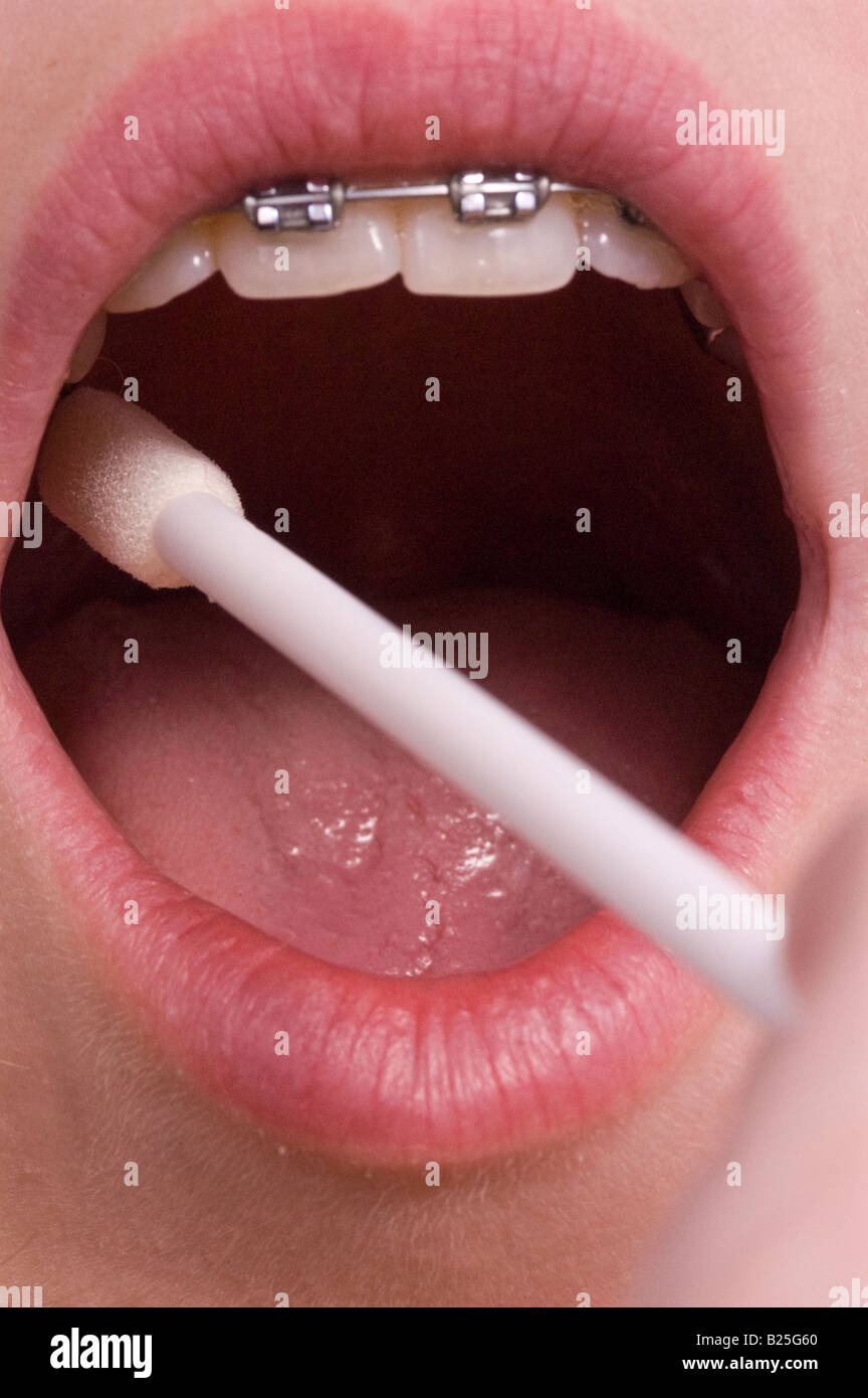 DNA mouth swab on a female Stock Photo - Alamy
