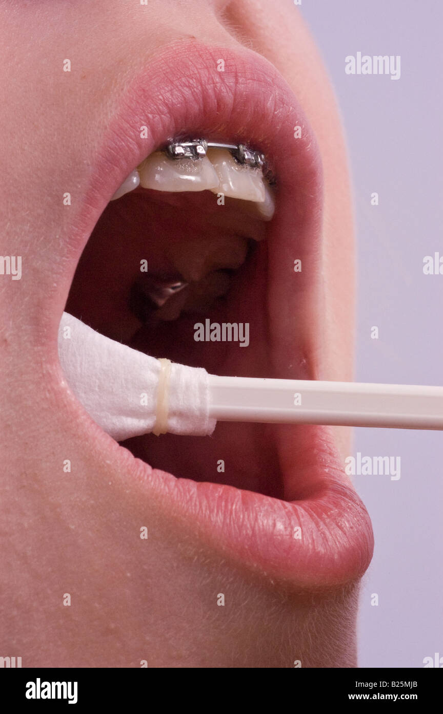 DNA mouth swab on a female Stock Photo - Alamy