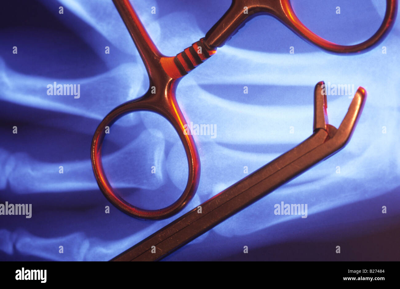 STAINLESS SCISSOR CLAMP X RAY IMAGE IN BACKGROUND Stock Photo - Alamy