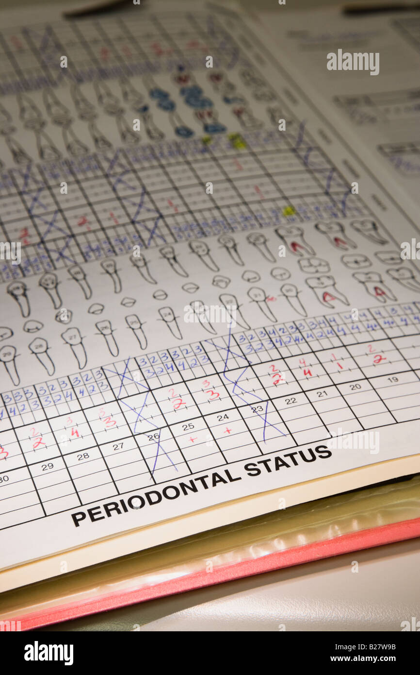 Tooth chart hi-res stock photography and images - Alamy