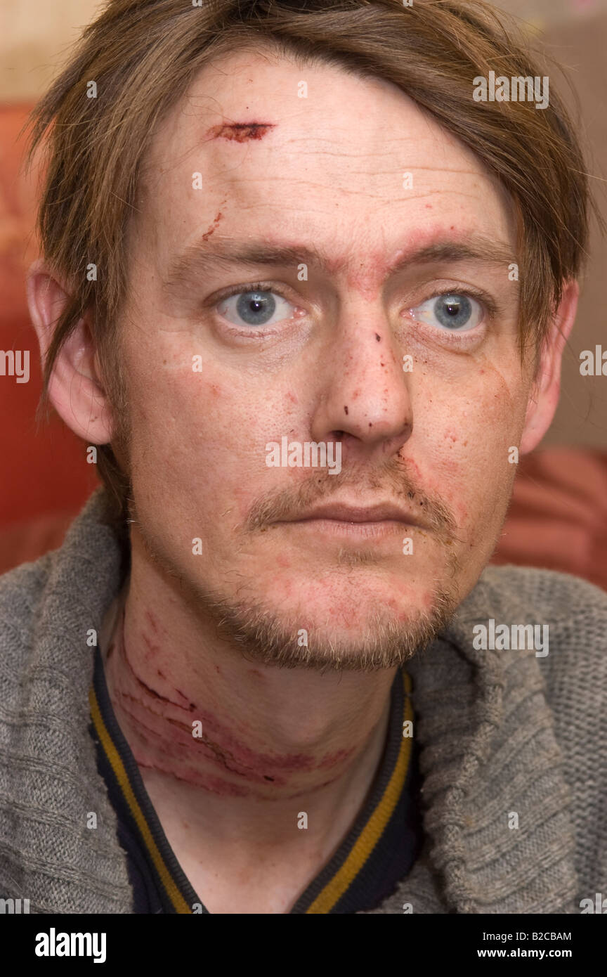Neck knife injury hi-res stock photography and images - Alamy