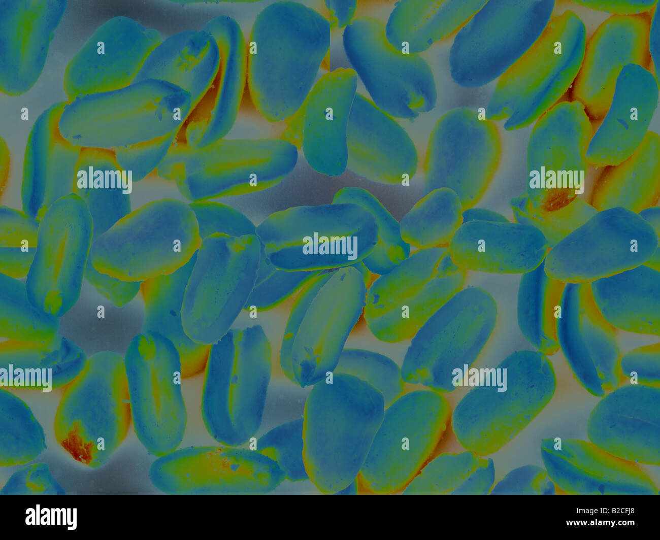 Infra Red Microscopic View of lots of Bacteria Stock Photo - Alamy