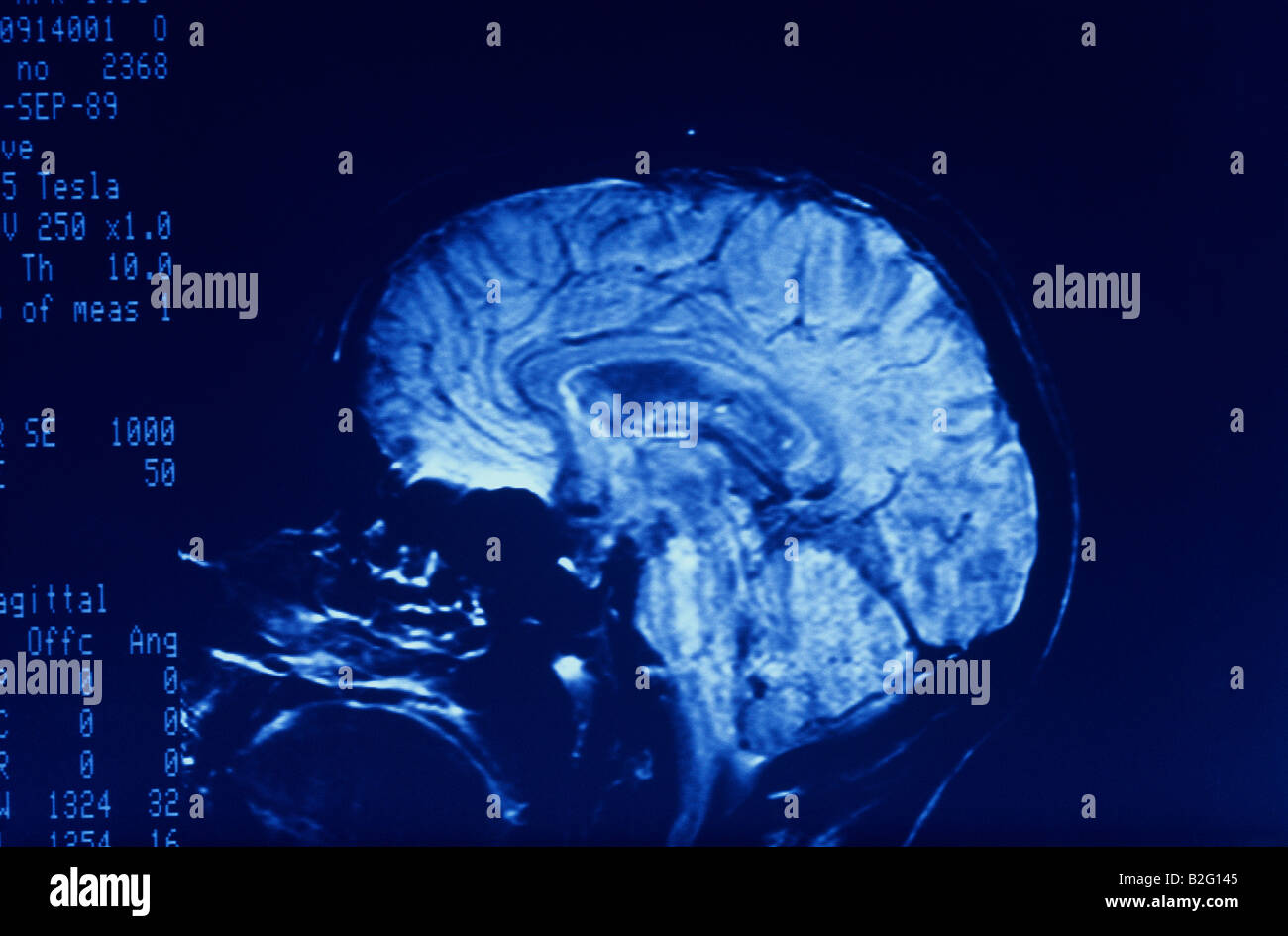 Cat brain anatomy hi-res stock photography and images - Alamy