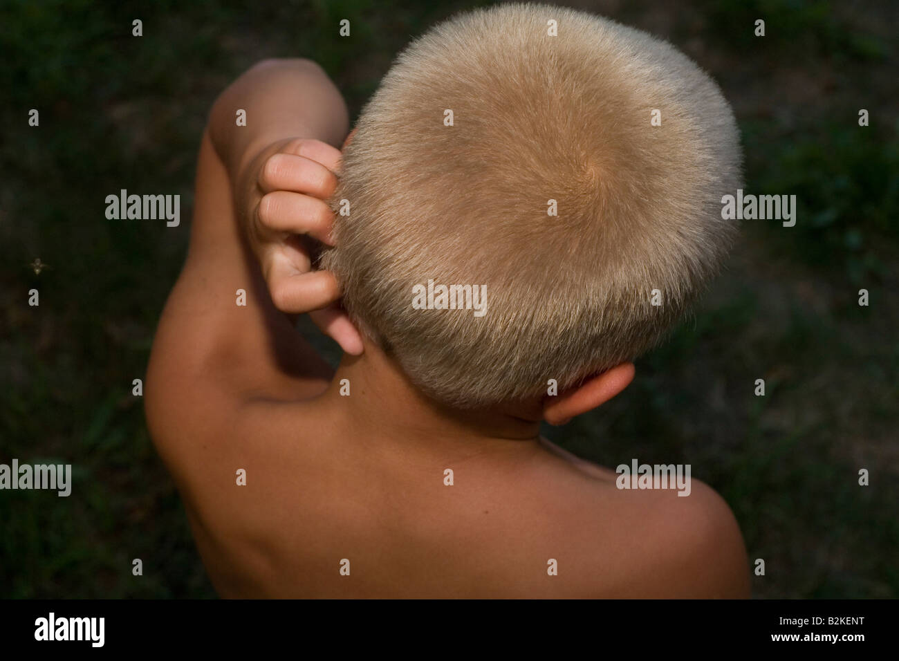 Insect bite child hi-res stock photography and images - Alamy