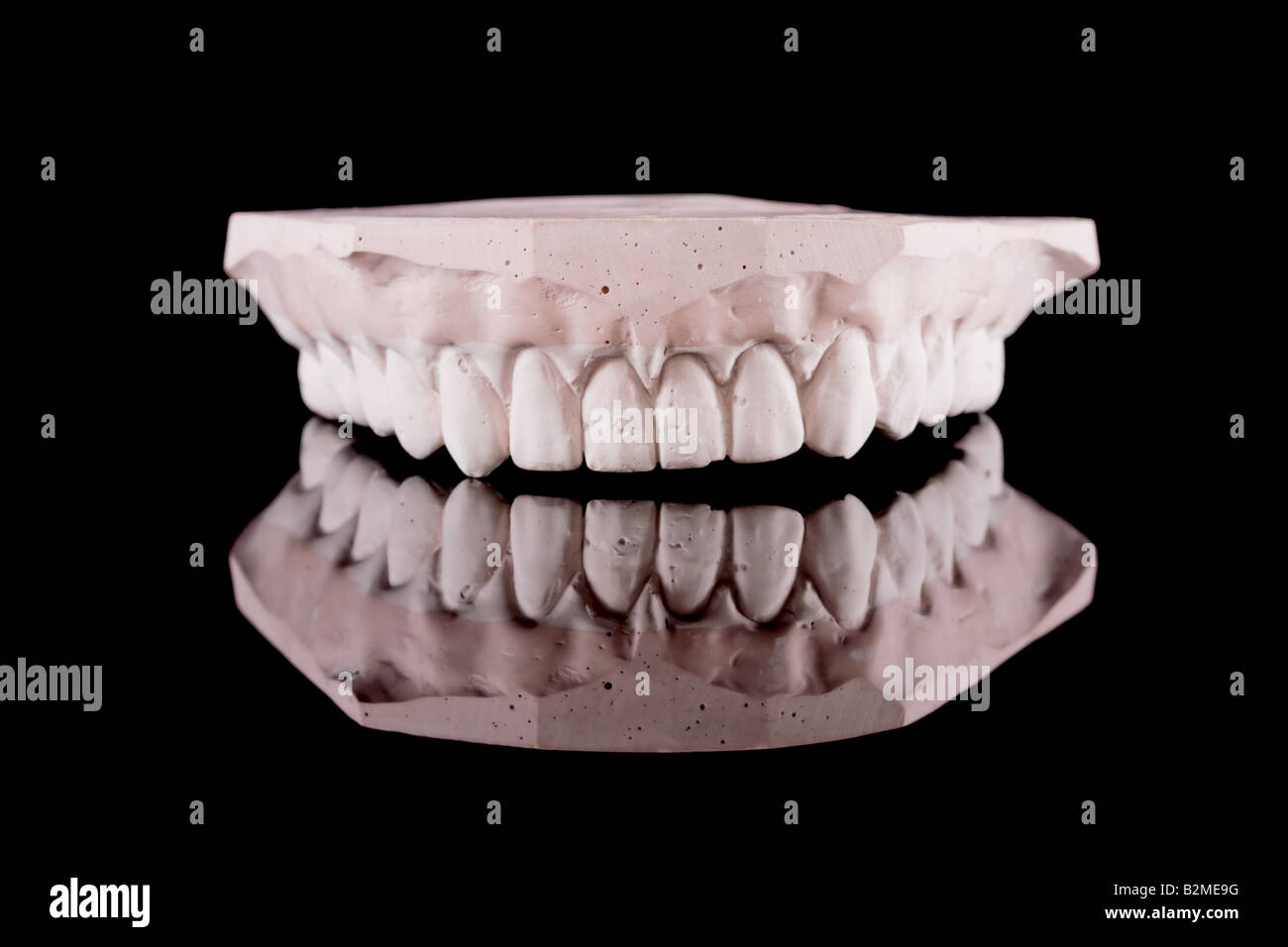 gypsum model of a human teeth on black background Stock Photo - Alamy