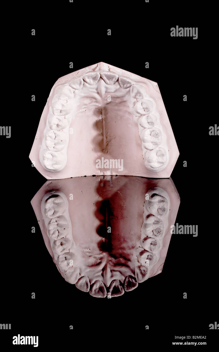 gypsum model of a human teeth on black background Stock Photo - Alamy