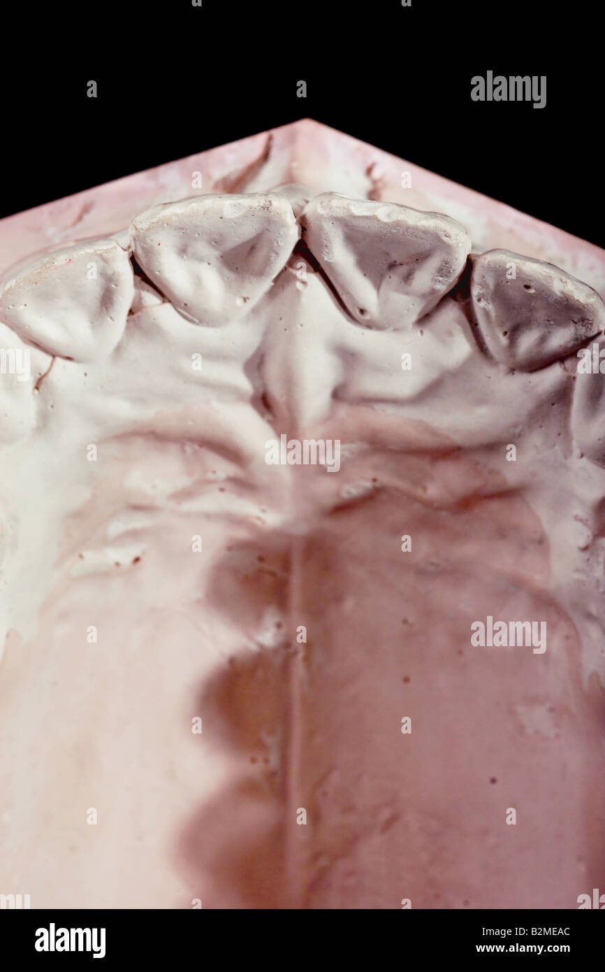 gypsum model of a human teeth on black background Stock Photo - Alamy