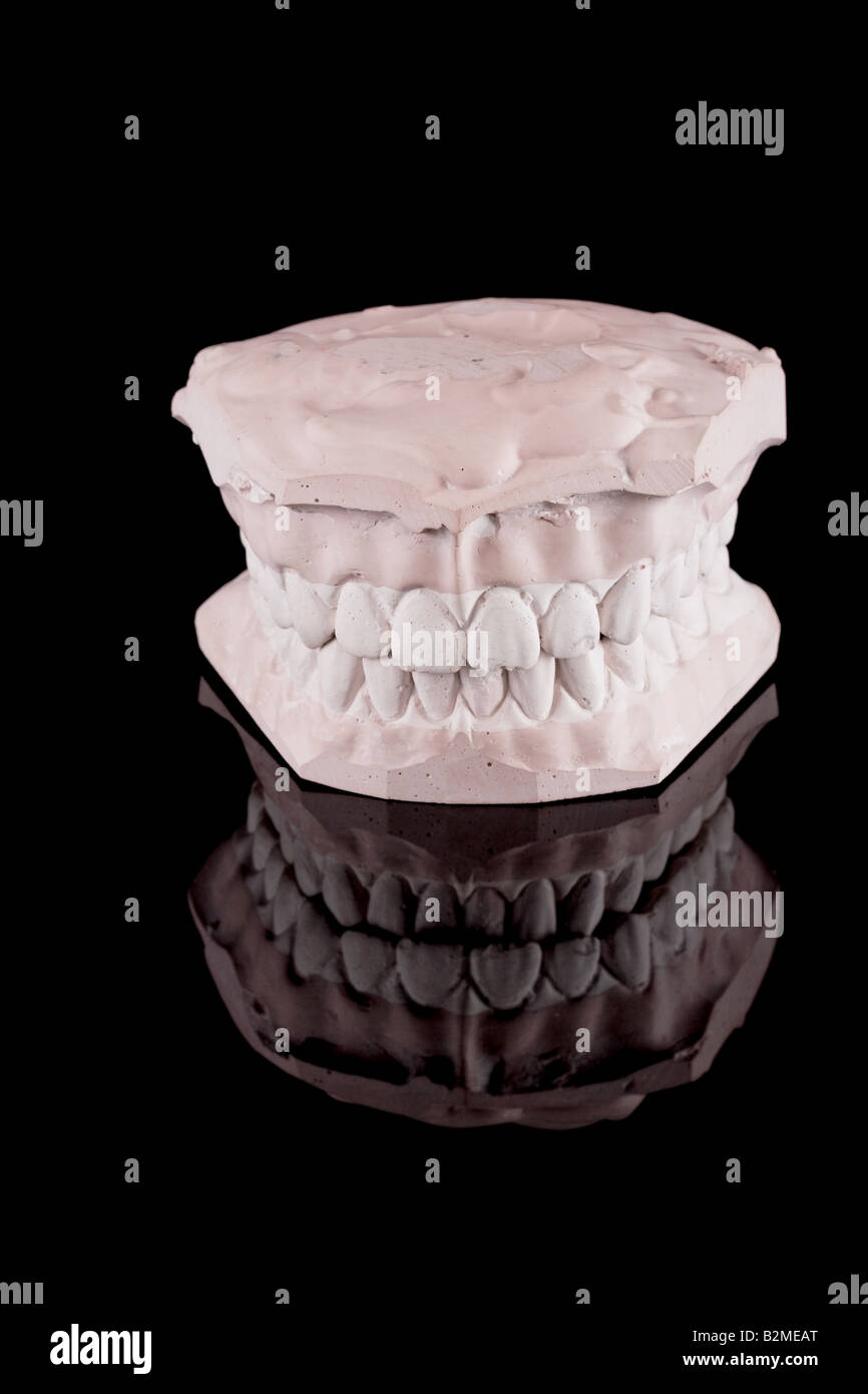 gypsum model of a human teeth on black background Stock Photo - Alamy