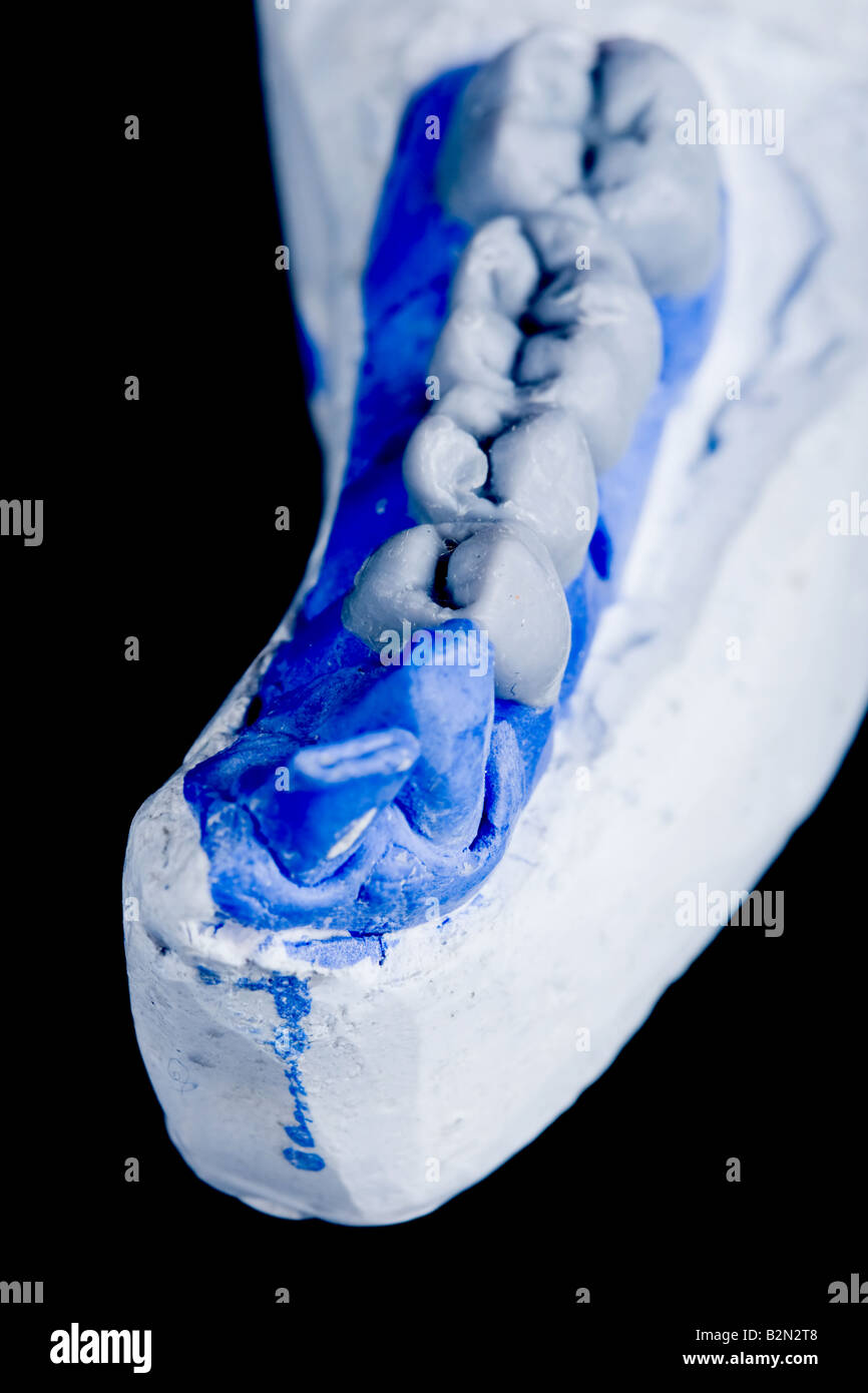 gypsum model of a human teeth on black background Stock Photo - Alamy