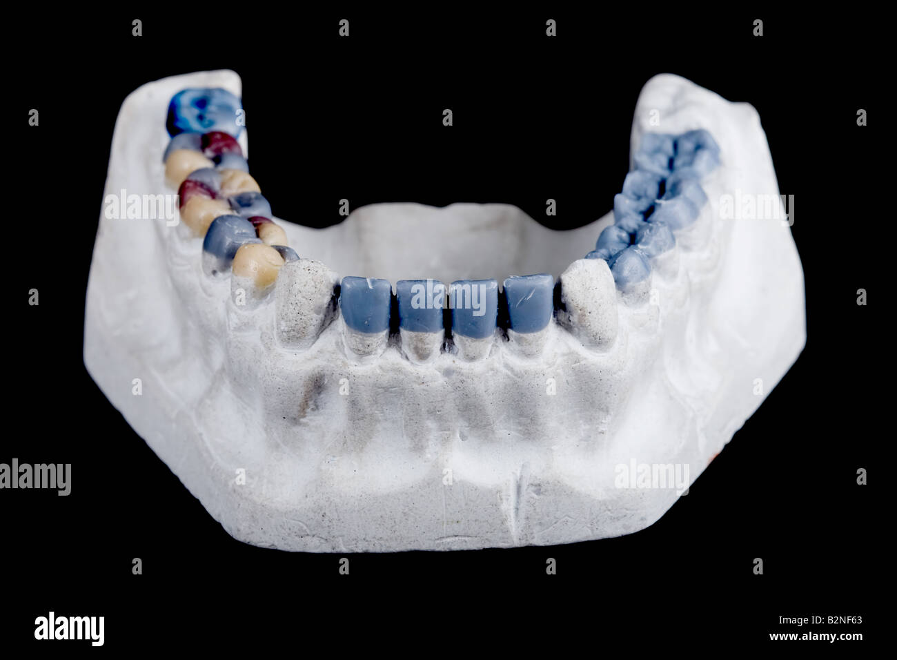 gypsum model of a human teeth on black background Stock Photo - Alamy