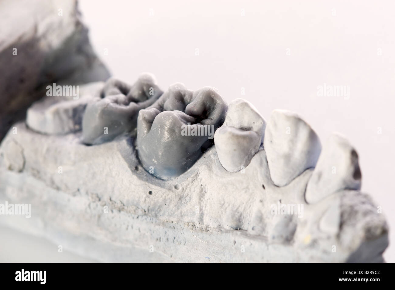 gypsum model of a human teeth on white background Stock Photo - Alamy