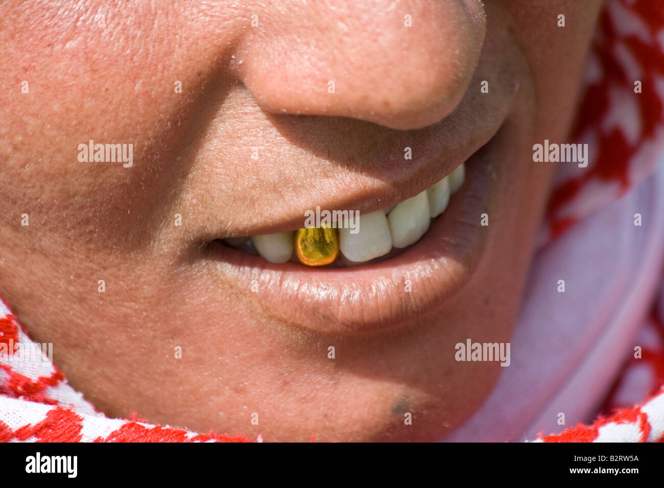 Gold tooth woman hi-res stock photography and images - Alamy