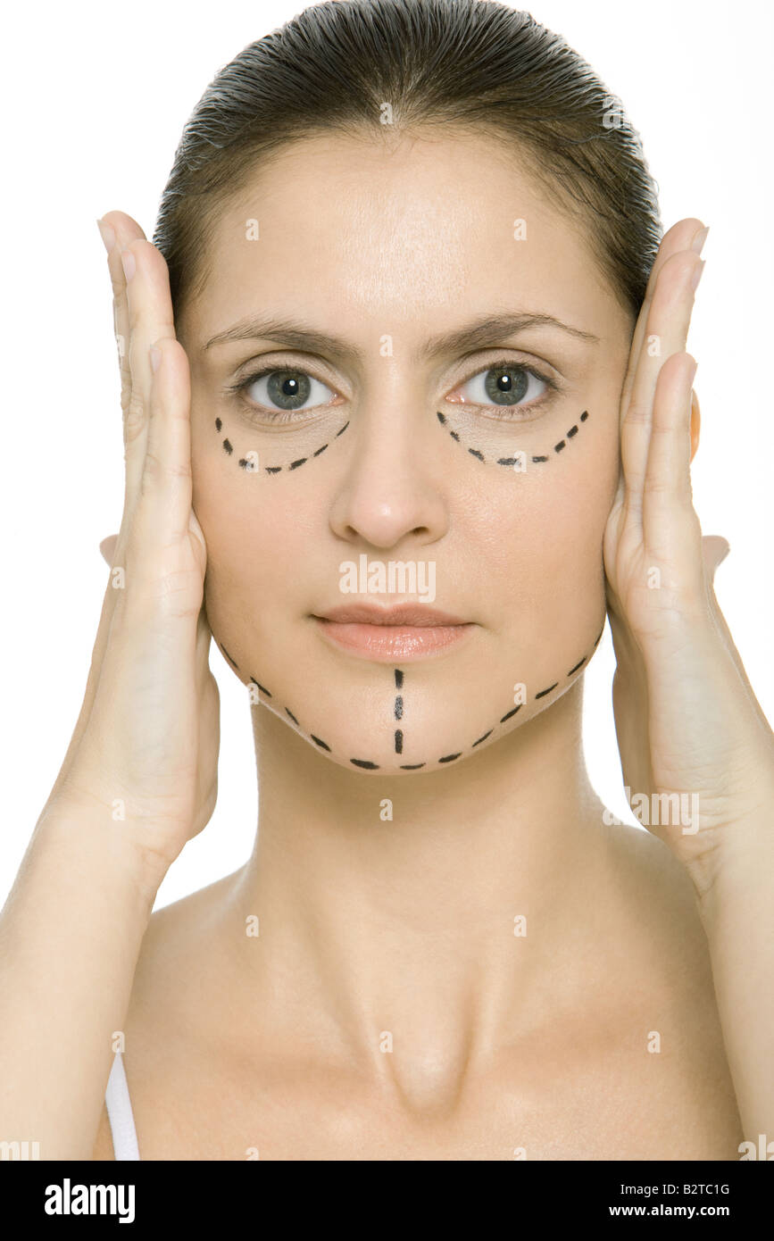 Woman with plastic surgery markings on face, holding face in hands ...