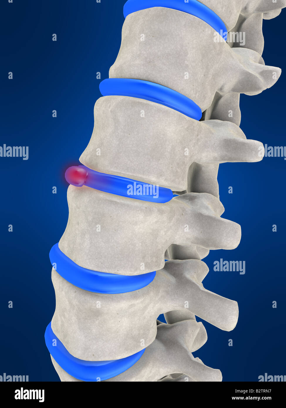 Slipped hi-res stock photography and images - Alamy