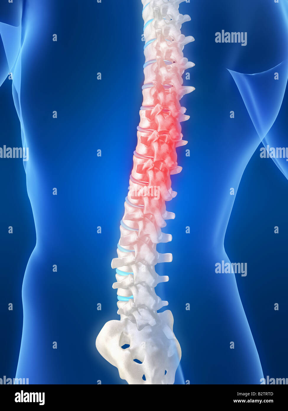 X ray human back spine hi-res stock photography and images - Alamy