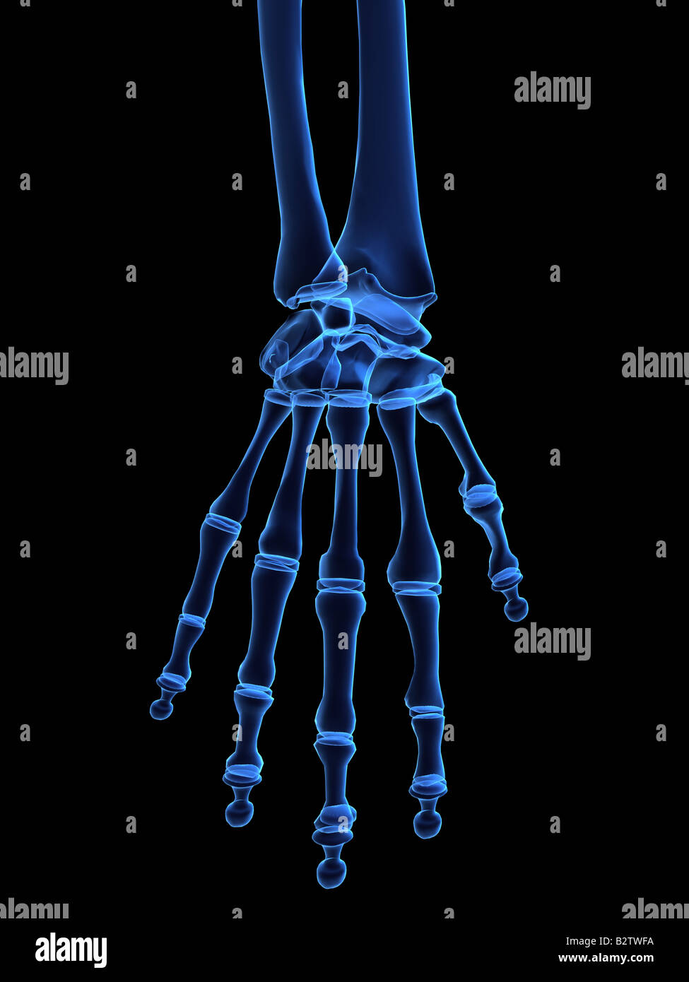 X ray wrist medical skeleton biology science anatomical hi-res stock ...
