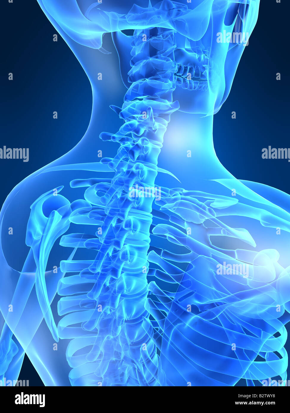 x-ray -human back Stock Photo - Alamy