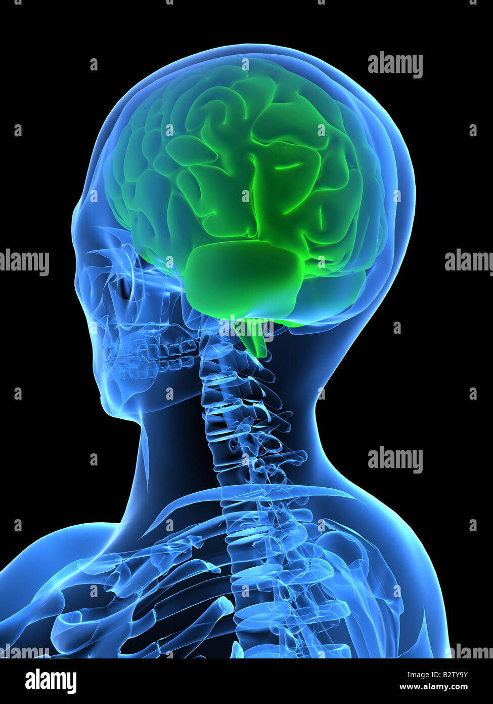 Inflammation of brain hi-res stock photography and images - Alamy