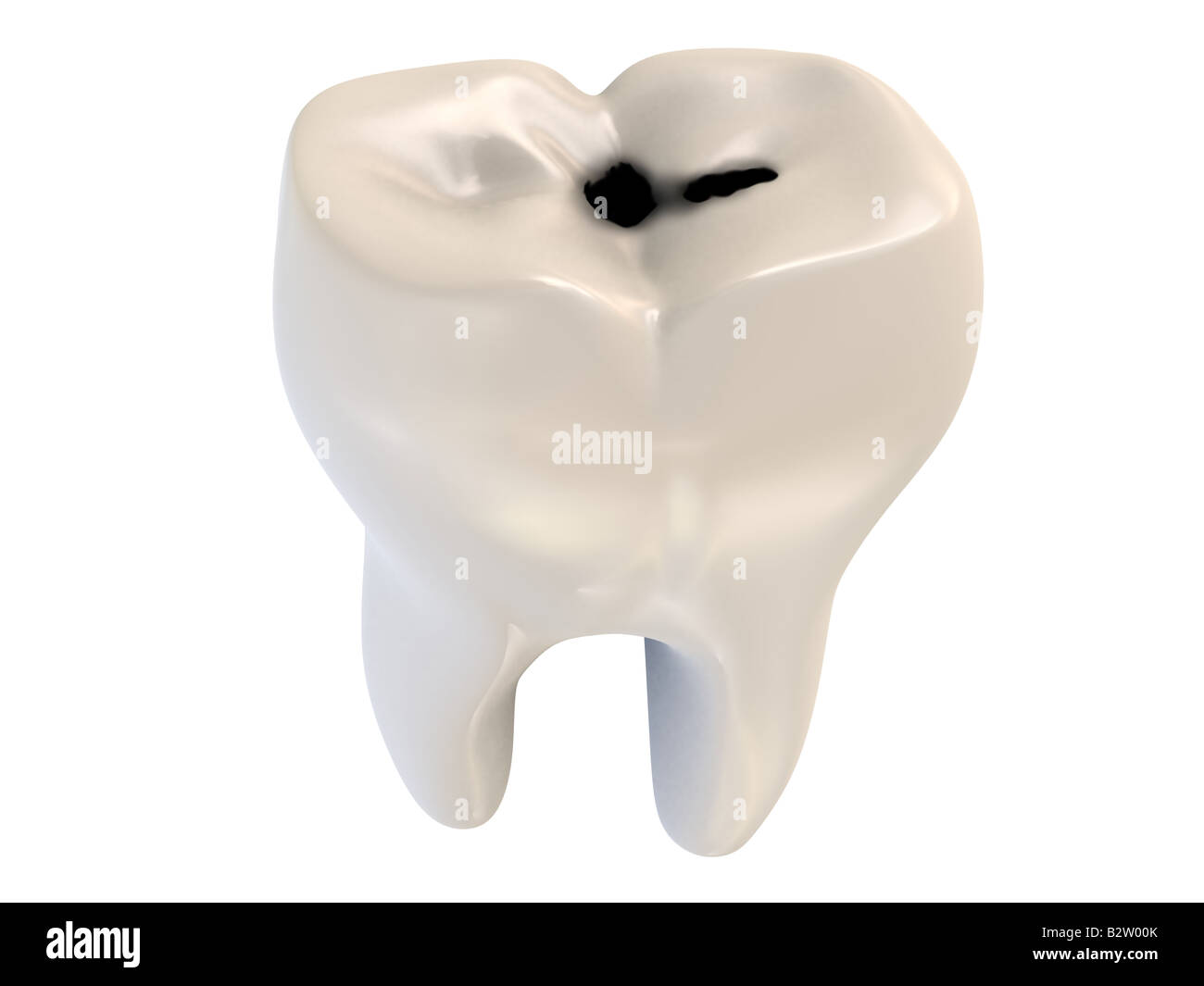 Anatomy teeth caries hi-res stock photography and images - Alamy