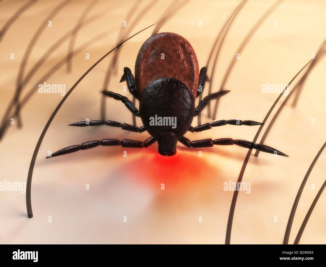 Tick bit hi-res stock photography and images - Alamy