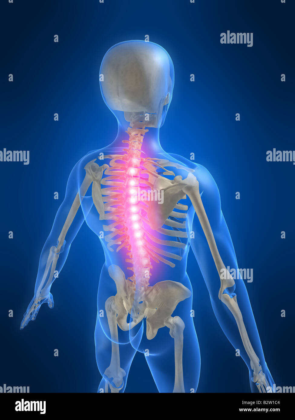 Osteoporosis Spine Stock Photos & Osteoporosis Spine Stock Images - Alamy