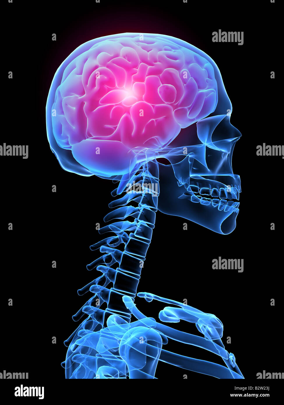 Brain ache hi-res stock photography and images - Alamy
