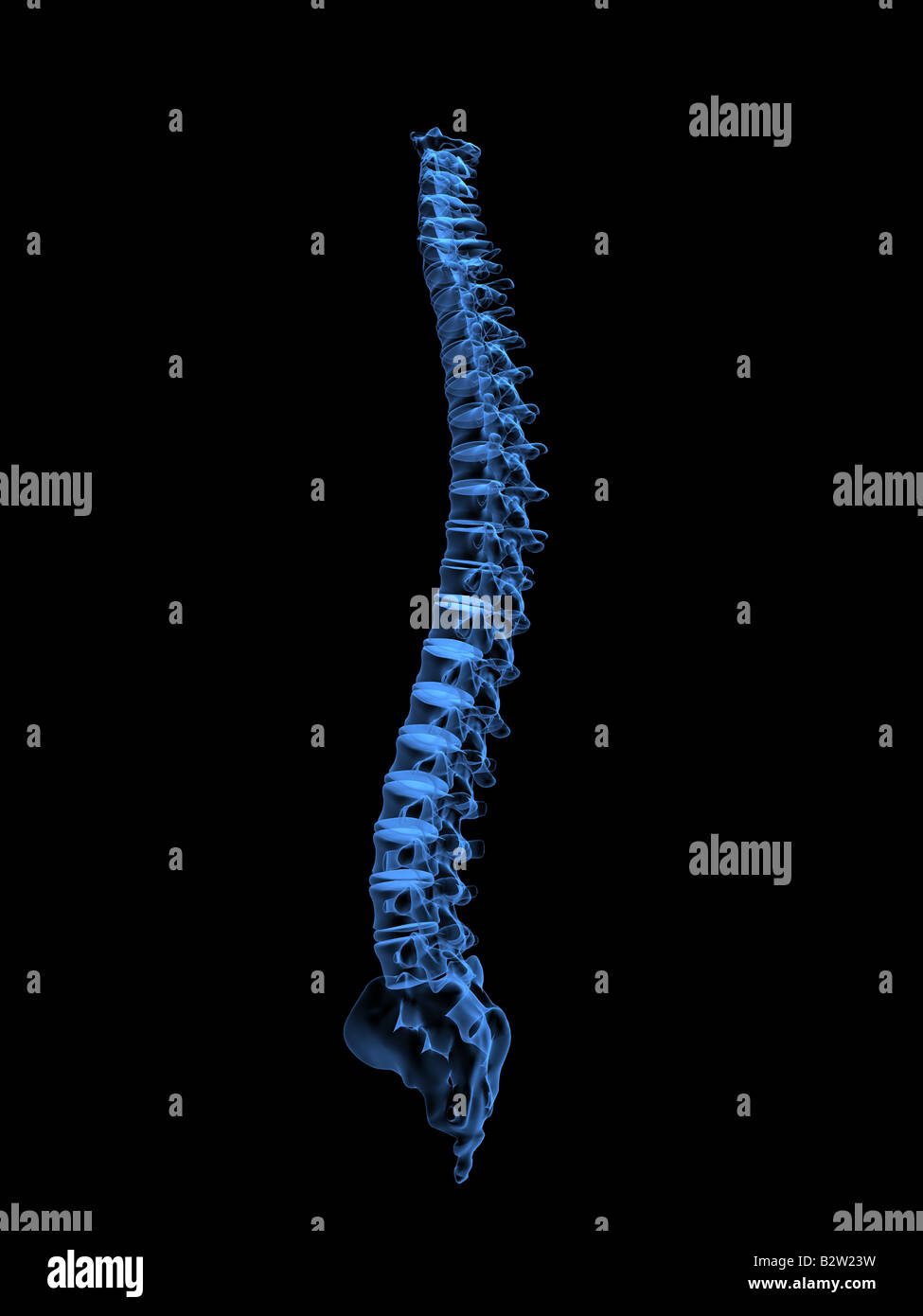 X ray human back spine hi-res stock photography and images - Alamy