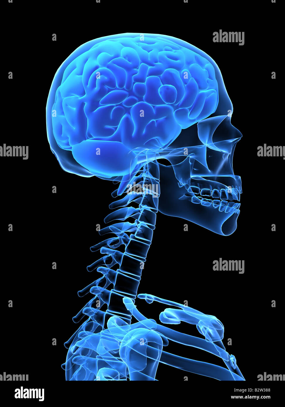 X ray of the human head hi-res stock photography and images - Alamy