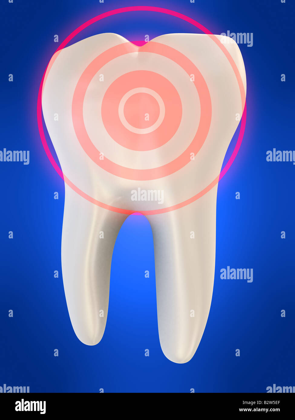 Human tooth pain hi-res stock photography and images - Alamy