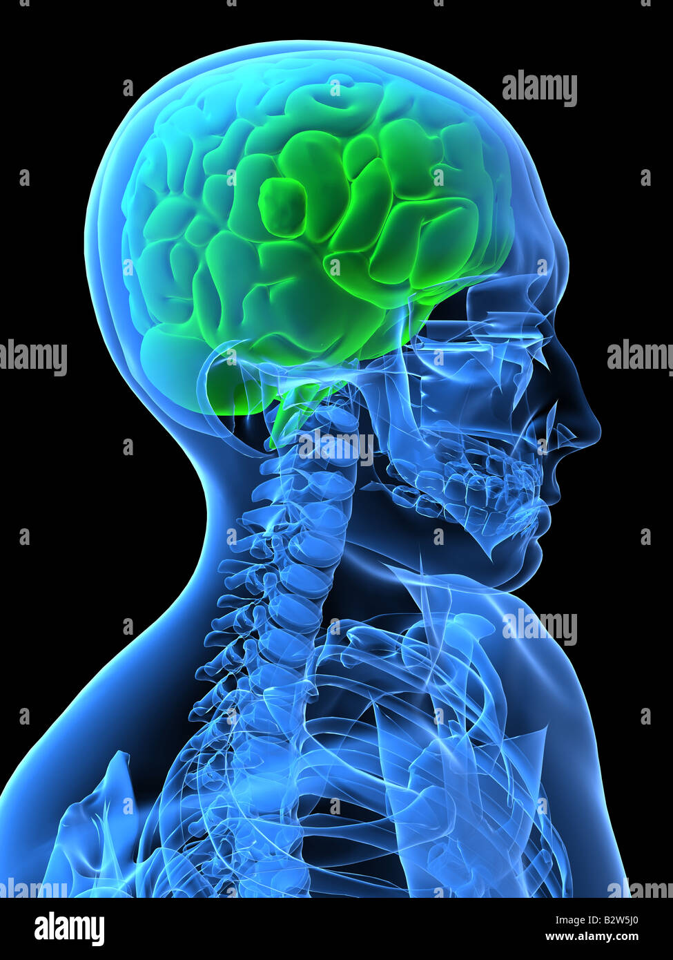 Inflammation of brain hi-res stock photography and images - Alamy