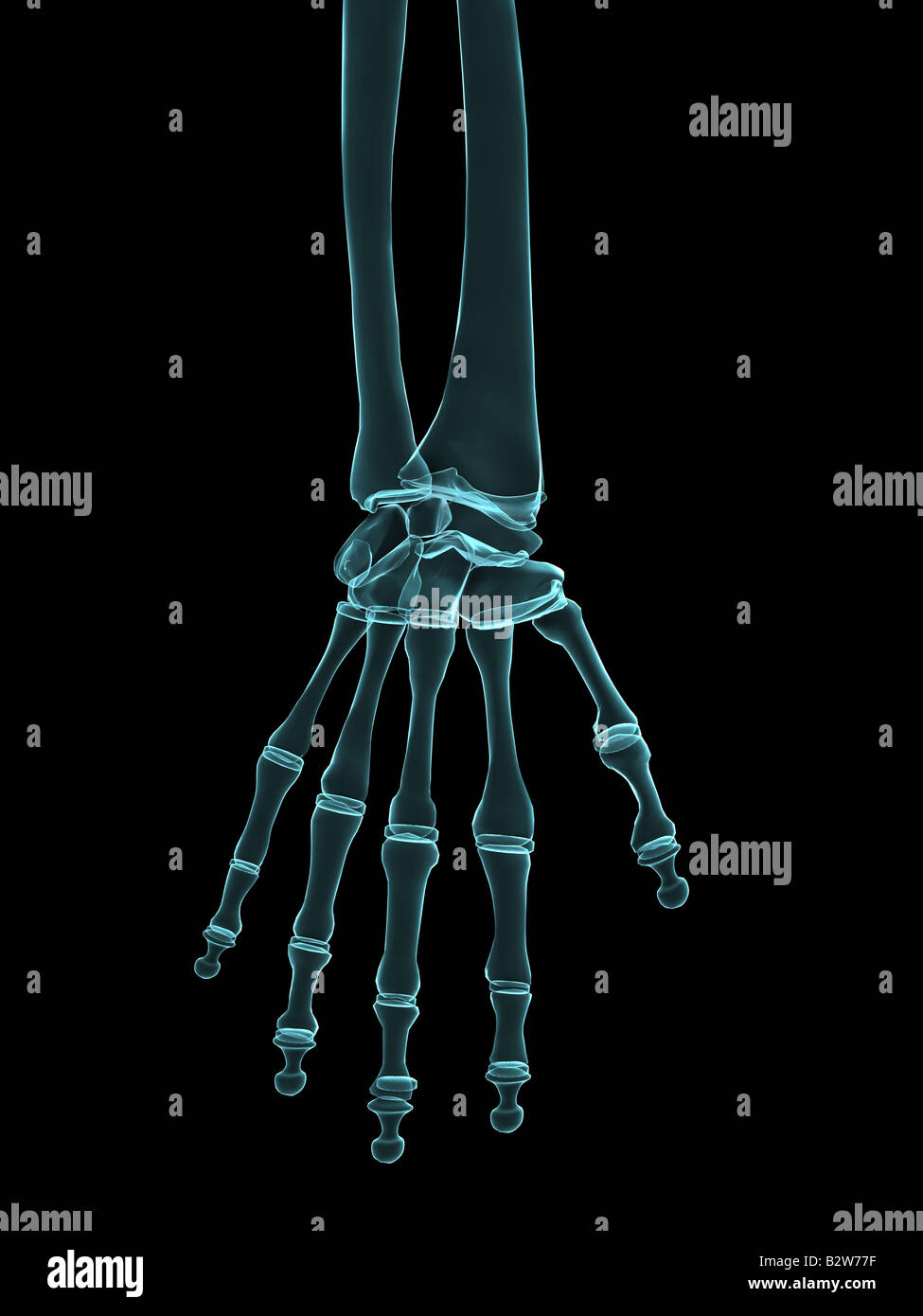 Human x ray hand hi-res stock photography and images - Alamy