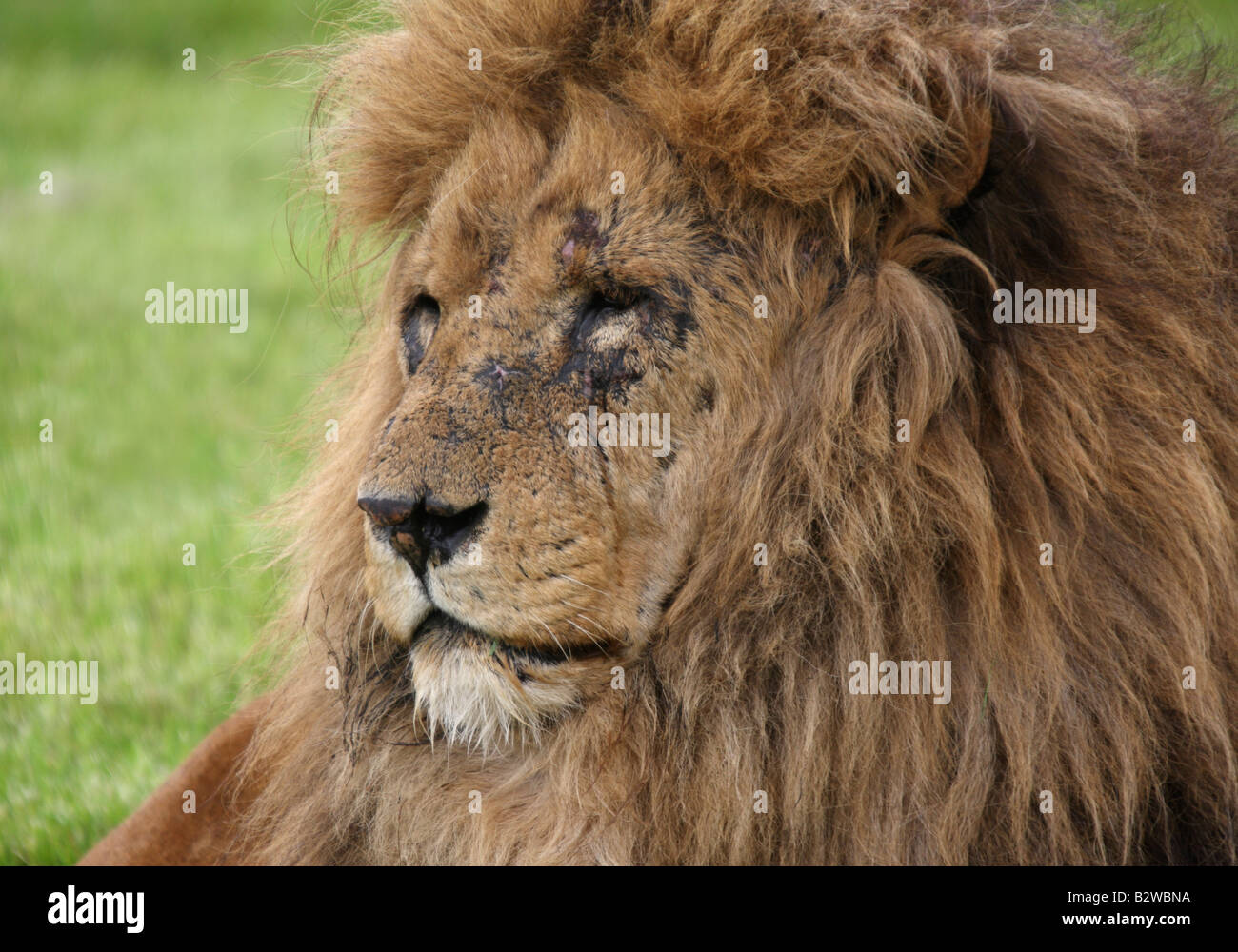 Head scar hi-res stock photography and images - Alamy