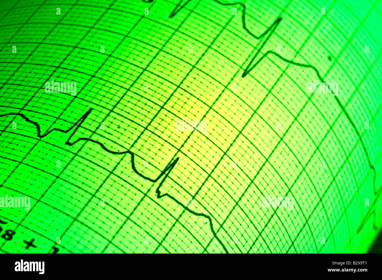 Ecg Ekg Graph Background Ecg Graph Free Stock Photos, Images, And