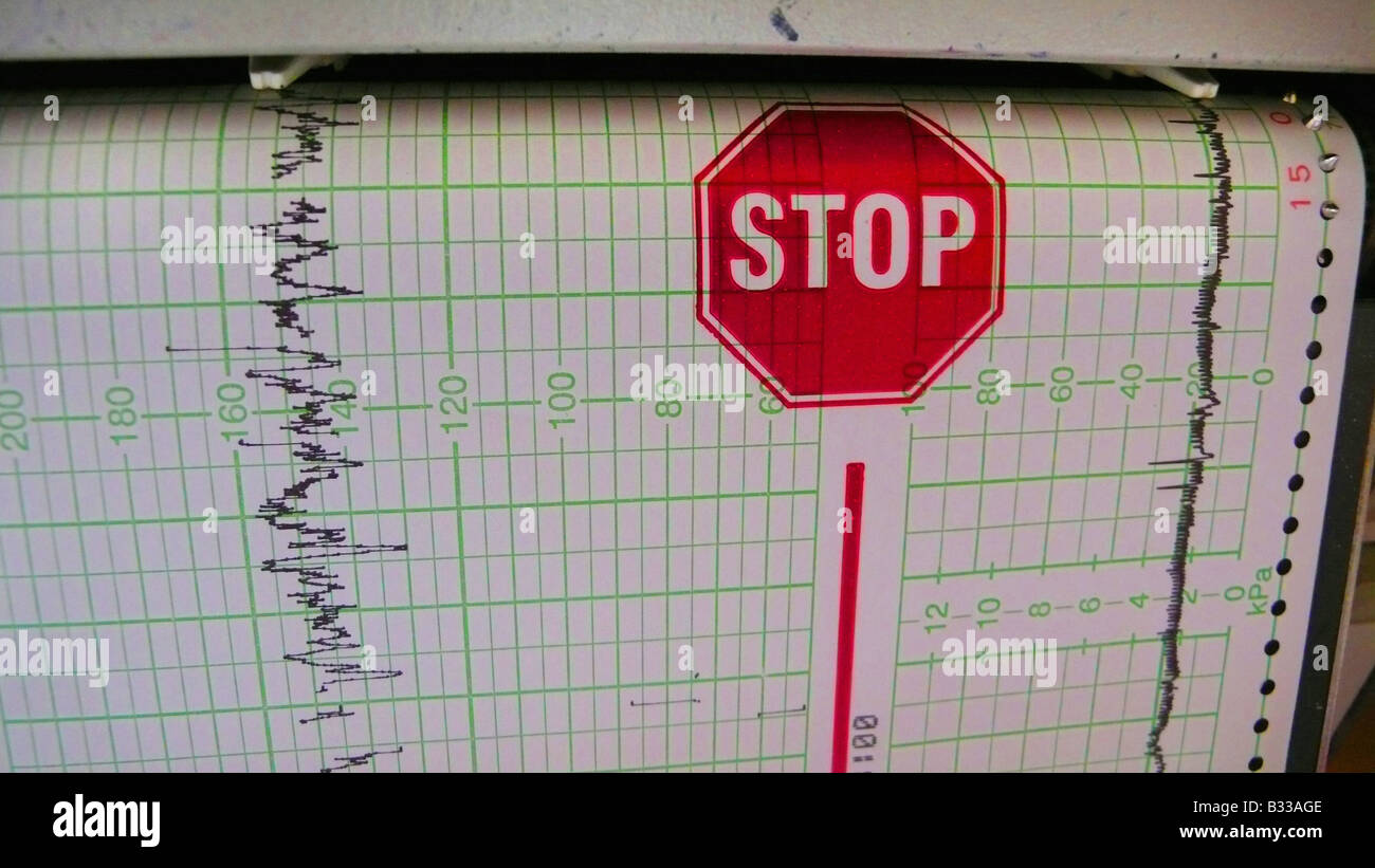 Cardiotocograph aufzeichnen aufzeichnend hi-res stock photography and ...