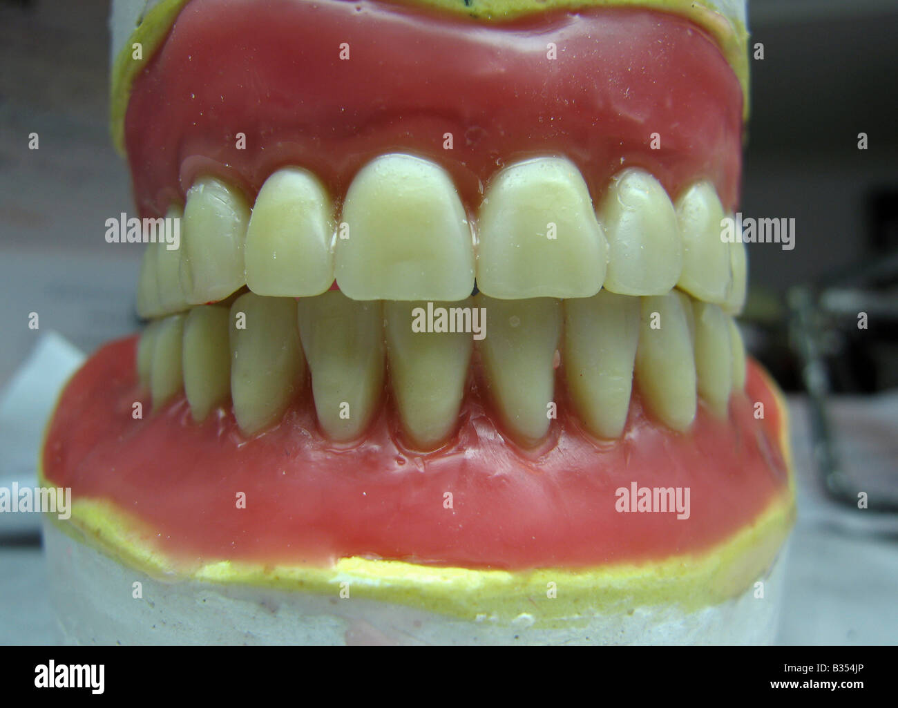 Denture model hi-res stock photography and images - Alamy