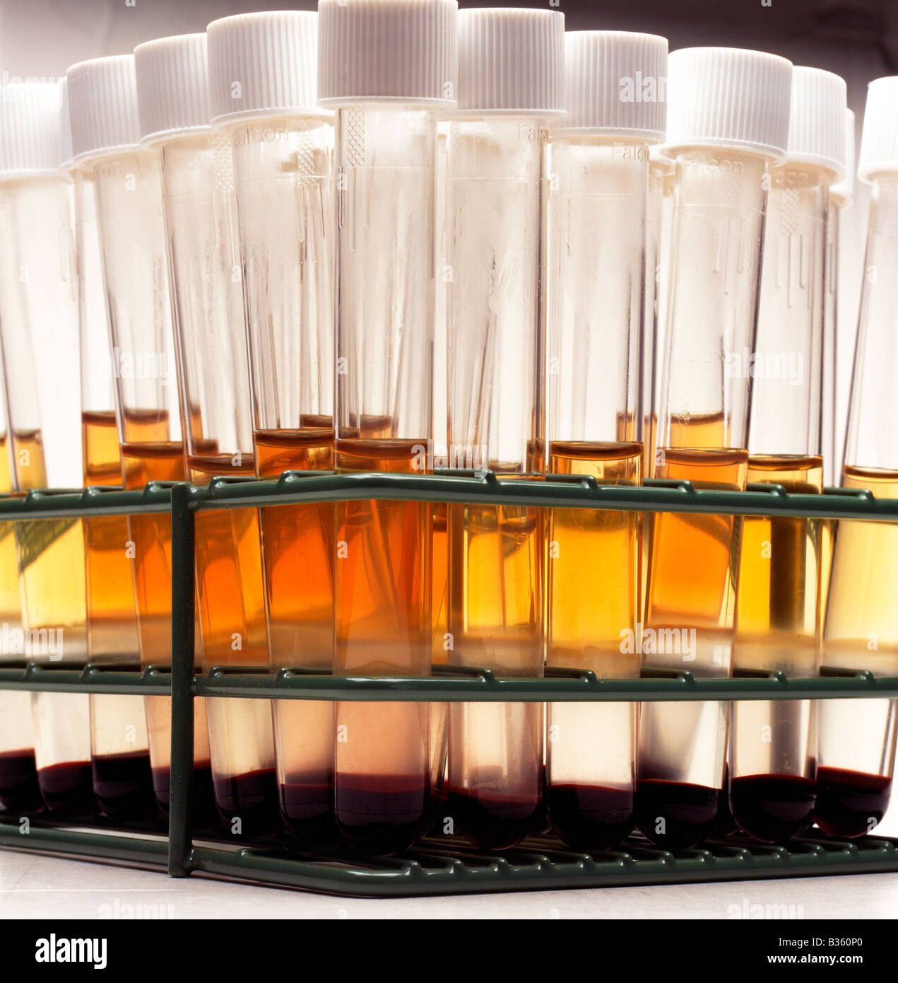 TEST TUBES OF HUMAN CELLS IN A LABORATORY AT A BIOMEDICAL RESEARCH ...