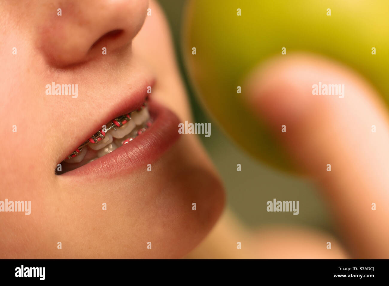Female teenager with braces eating an apple Stock Photo - Alamy