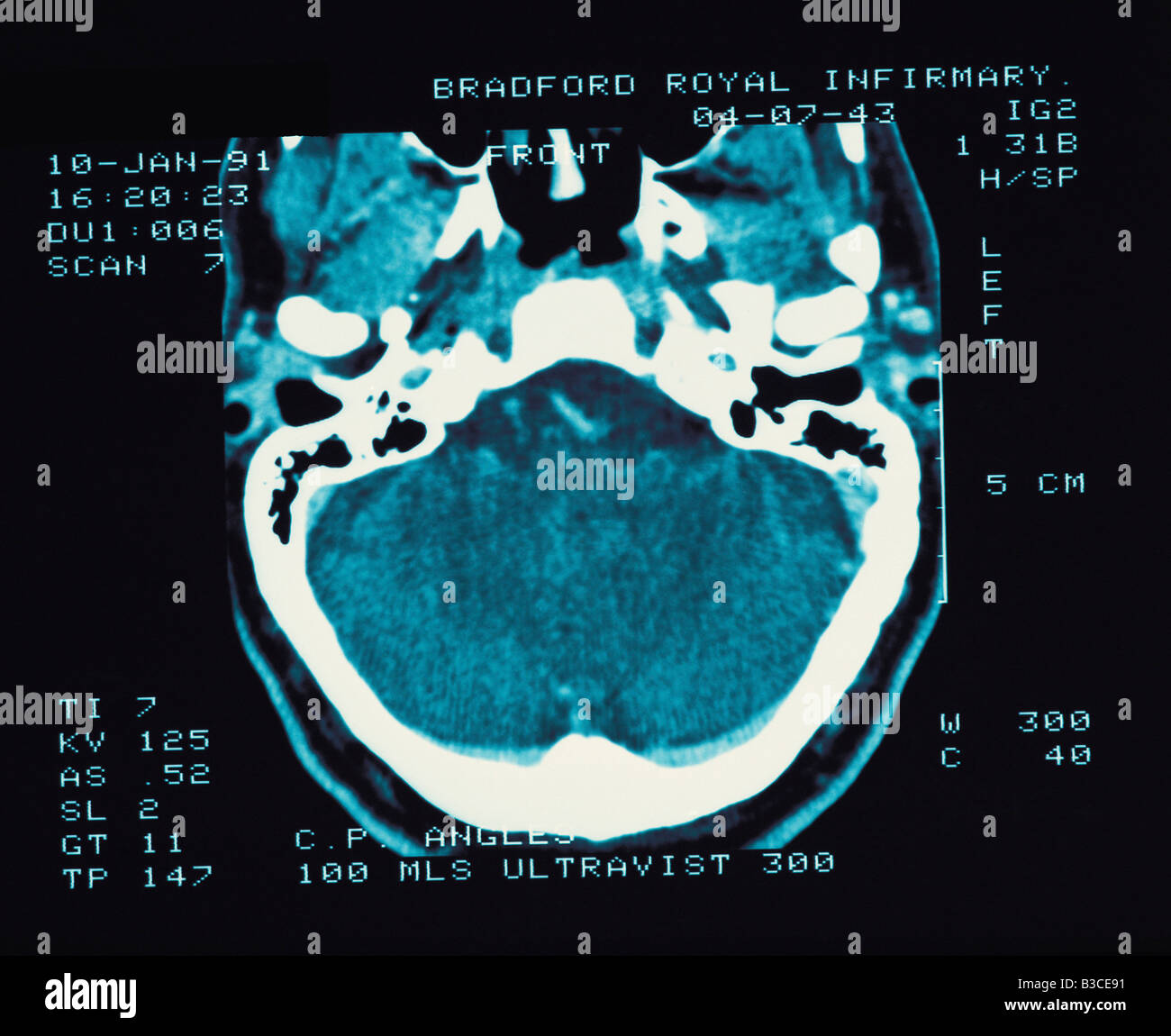 Human brain from above hi-res stock photography and images - Alamy