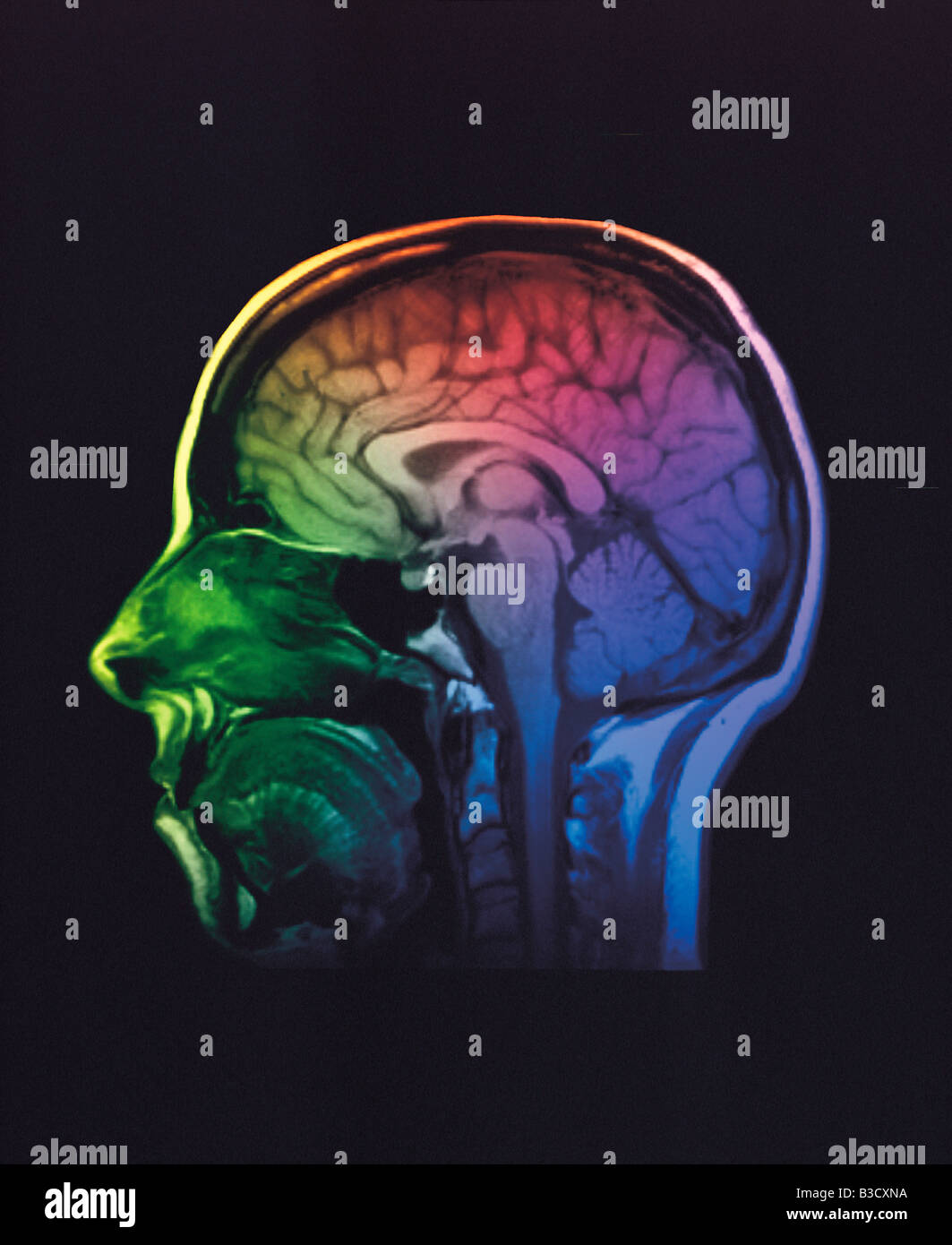 Human Head Profile With Brain