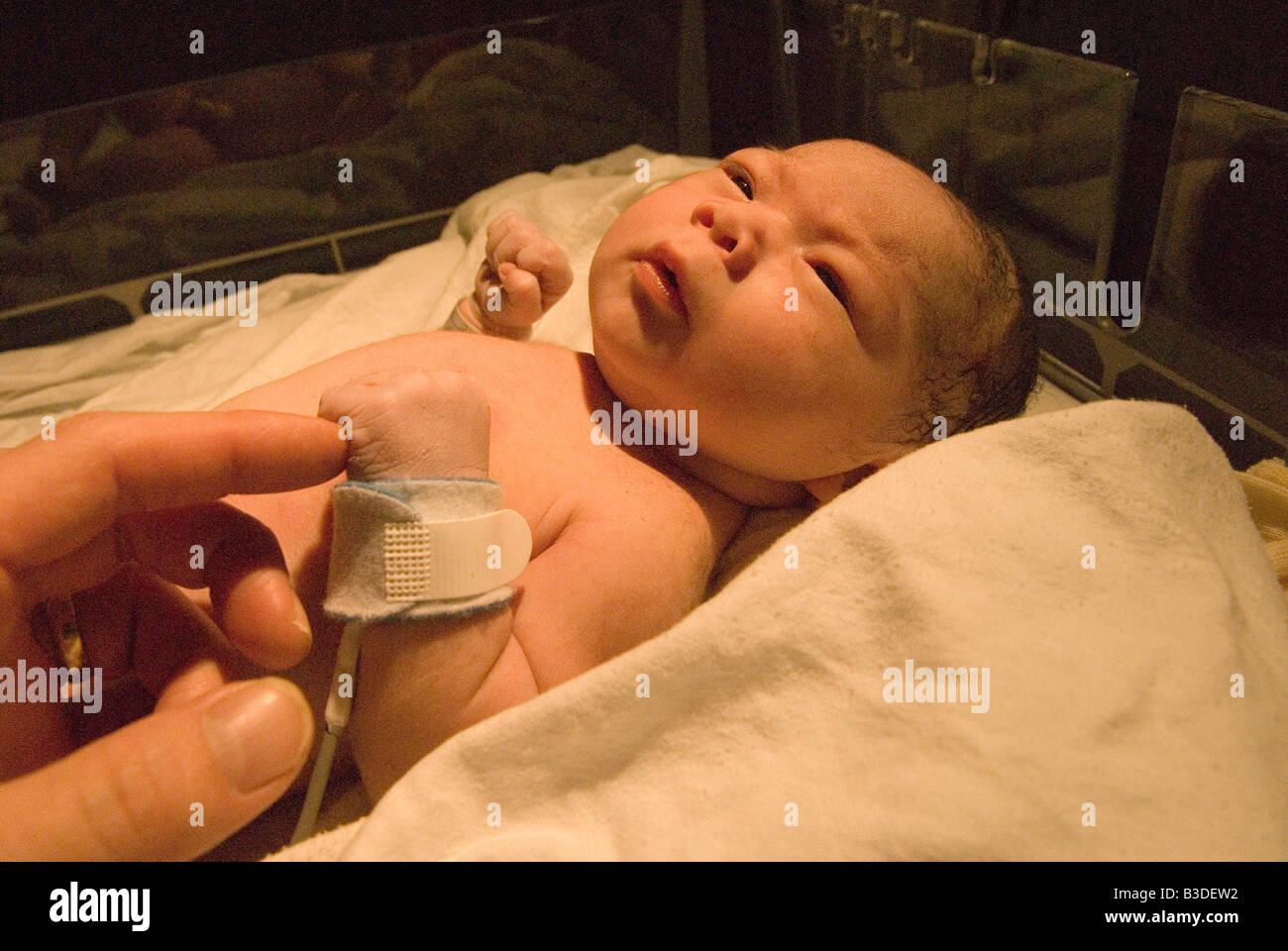 Infant girl in an incubator, under a sun lamp Stock Photo - Alamy