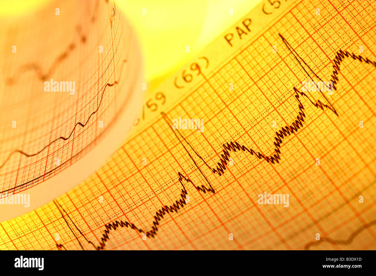 Ecg Graph Stock Photos & Ecg Graph Stock Images - Alamy